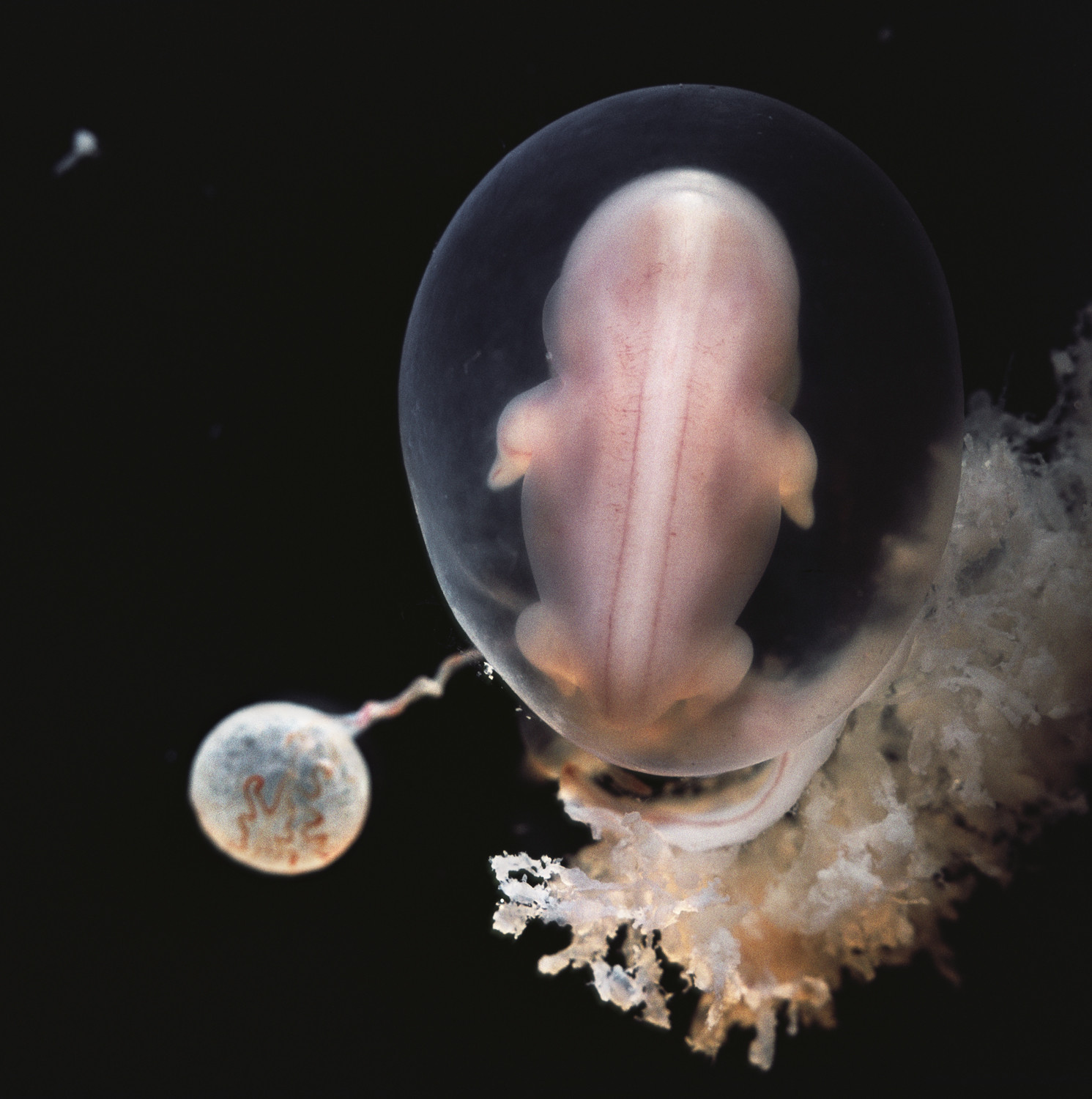 Marc Bygdeman - Lennart Nilsson Photography