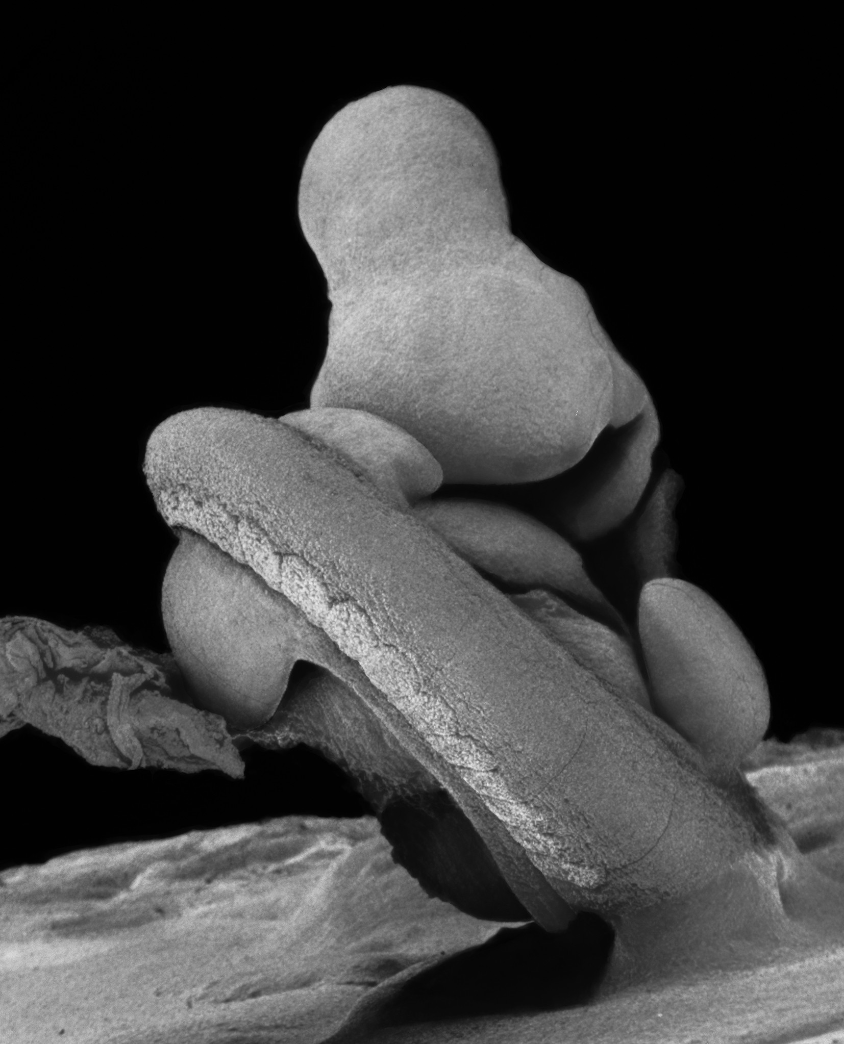 Embryonic Studies - Lennart Nilsson Photography